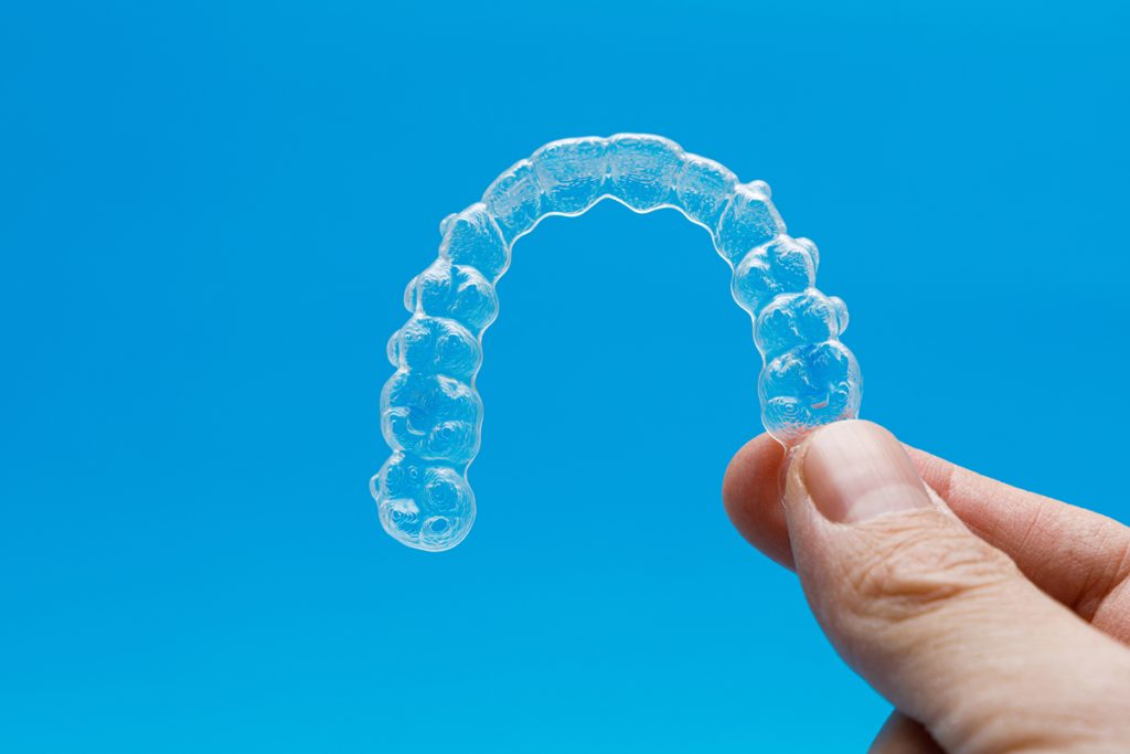 Can You Get A Permanent Retainer On Your Top Teeth? - Articles321